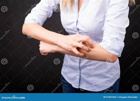 Vrouw Die Een Allergische Reactie Hebben Stock Foto Image Of