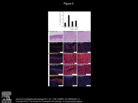C Jun Promotes Whereas Junb Inhibits Epidermal Neoplasia Ppt Download