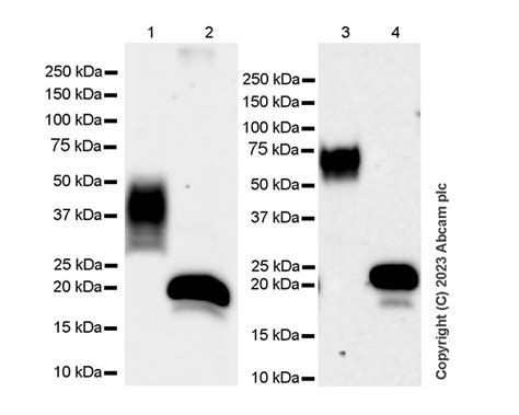 Anti Cd63 Antibody [rm1095] Ab315108 Abcam