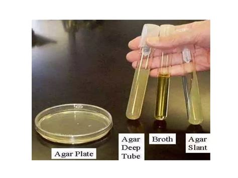 Microbial Culture Preservation And Its Methods Pptx