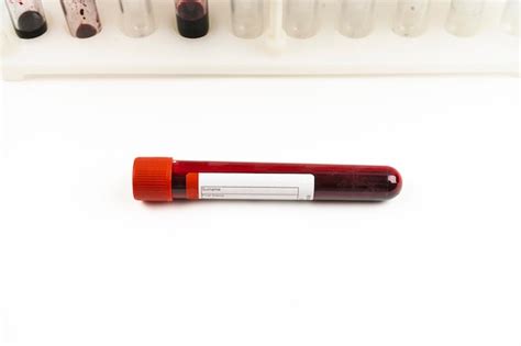 Premium Photo Test Tube Containing A Test Sample