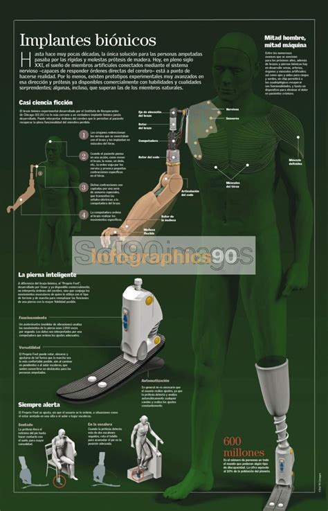 Infographics Bionic Implants Infographics90