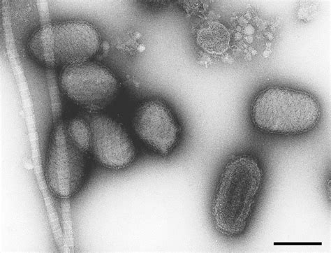 Rki Consultant Laboratory For Diagnostic Electron Microscopy Of