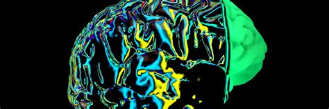 Larger White Matter Hyperintensities Volume Identified In Women With