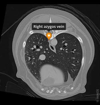 Right Azygos Vein Vet Anatomy Imaios