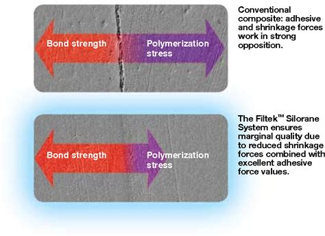 Figure 4 From Filtek Tm Silorane Low Shrink Posterior Restorative