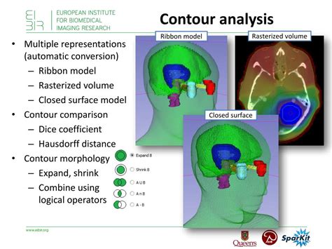 Ppt Slicerrt Image Guided Radiation Therapy Research Toolkit For D Slicer Powerpoint