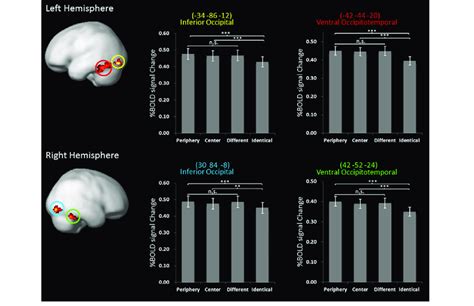 Neural Sensitivity To Character Form Variations Observed In Bilateral Download Scientific