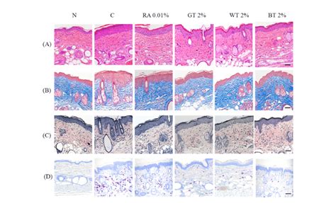 Histological Observation On Skh 1 Hairless Mice Skin Applied With Test