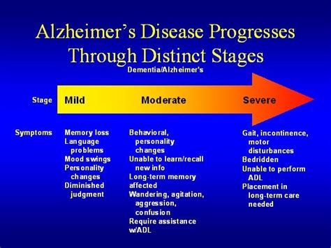 Alzheimers Disease Progresses Through Distinct Stages Dementia