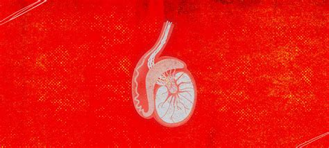 Testicular Cancer Fertility At Lynda Rahman Blog