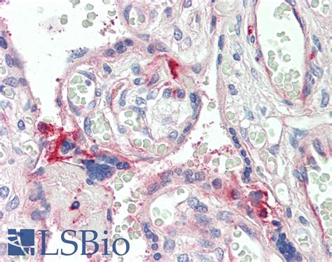 IHC Plus Complement C7 Polyclonal Antibody Goat Anti Human LSBio