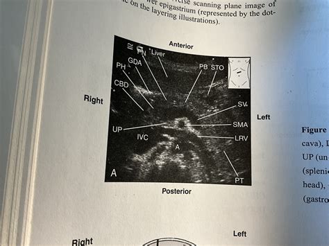 Identify Diagram Quizlet