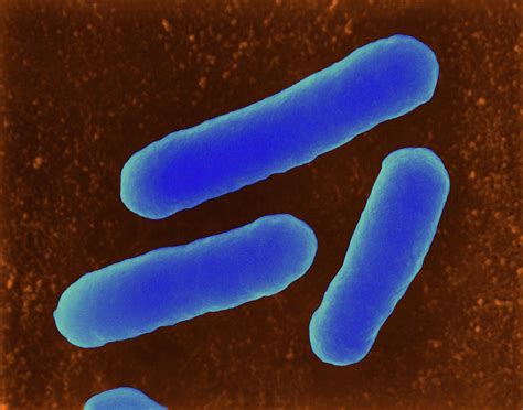 E Coli Photograph By Dennis Kunkel Microscopyscience Photo Library