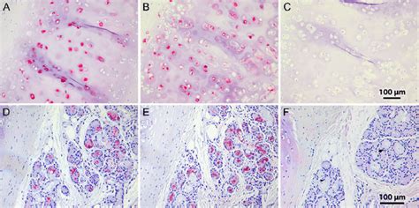 Chondroitinase Abc Chabc Treatment Of Human Trachea Tissue Sections
