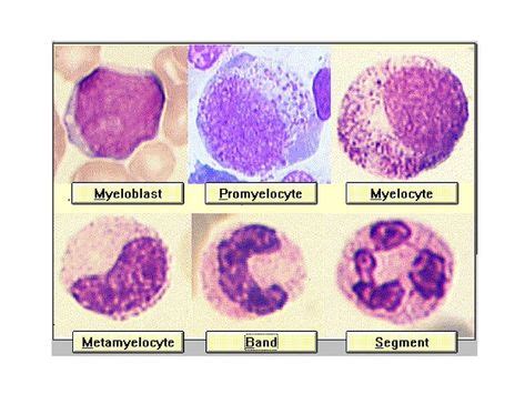 Hematology Slides Ideas In Hematology Medical Lab