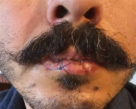 بالاترین «حسین رونقی در یادداشتی نوشت برای بچه‌های اکباتان، به کنش اعتراضی خود با لب دوخته‌شده