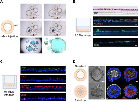 The Explorations On The Improvement Of Intestinal Organoid Culture A