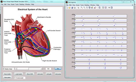 Model Based Development Of Implantable Cardiac Devices