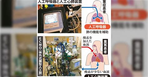 コロナ重症病棟 医師たちの闘い 長期取材で見えた真実後遺症と壮絶リハビリ 8ページ目 Togetter トゥギャッター