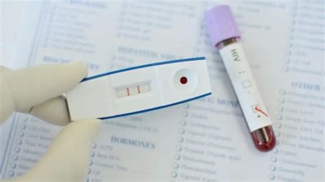 The Importance Of Regular Std Testing When And Why You Should Get
