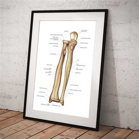 Bones Of Forearm 1 Poster By Science Photo Library Science Photo Gallery