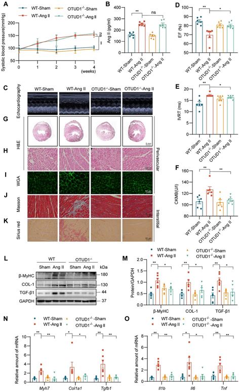 Otud1 Deficiency Protects Against Ang Ii Induced Myocardial Hypertrophy