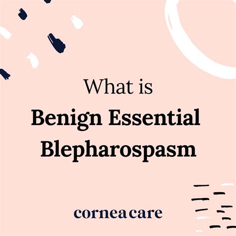 Benign Essential Blepharospasm Definition Corneacare