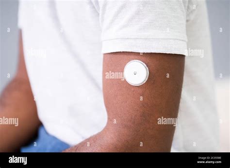 Close Up Of A Man Testing Glucose Level With A Continuous Glucose Monitor On His Arm Stock Photo