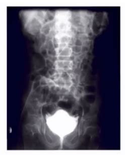 Urological Trauma And Indications Of Radiological Assessment