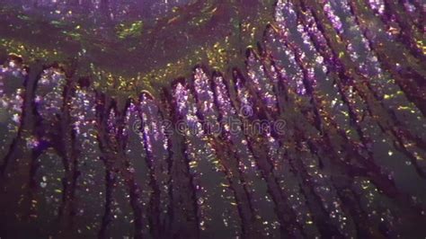 Macro Footage Of Human Colon Tissue Taken For Medical Check And