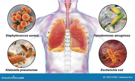 Human Respiratory Pathogens Stock Illustration Illustration Of