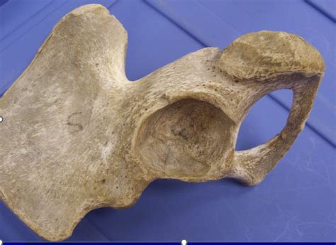 Os Coxae Diagram Quizlet