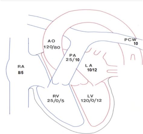 Dms 271 Echo Mod D Hemodynamics Flashcards Quizlet