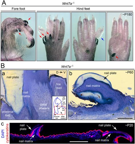The Wnt7awnt7bgpr124reck Signaling Module Plays An Essential Role In