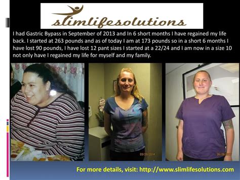 Ppt Gastric Bypass Surgery Powerpoint Presentation Free Download