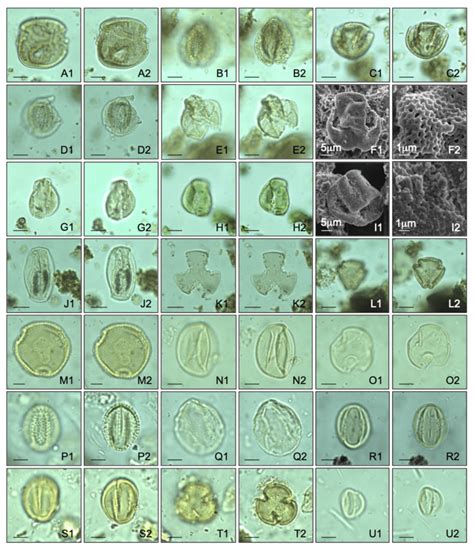 Photographs At Tlm And Sem Of Some Fossil And Modern Pollen Grains Of Download Scientific