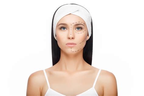 Rhinoplasty Surgery Miami Ideal Surgery Destination Dr Carlos Wolf