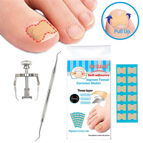 Ingrown Nail Correction Kit Ingrown Toenail Stickers Toe Nail Clamp