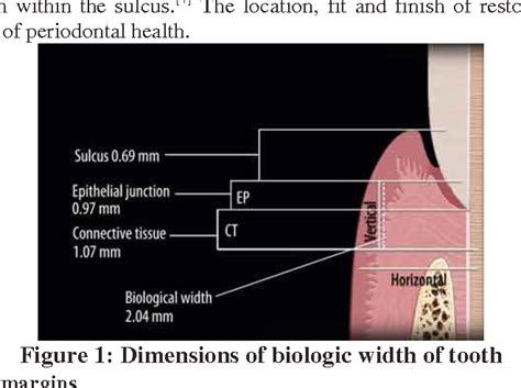 Figure 1 From Biologic Width Critical Zone For A Healthy Restoration