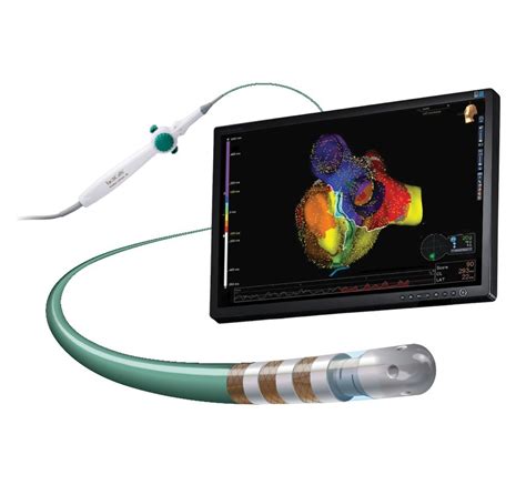 Abbott Announces Ce Mark For Tacticath™ Contact Force Ablation Catheter