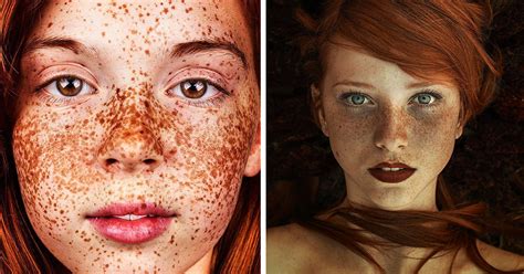 98 Freckled People Wholl Hypnotize You With Their Unique Beauty