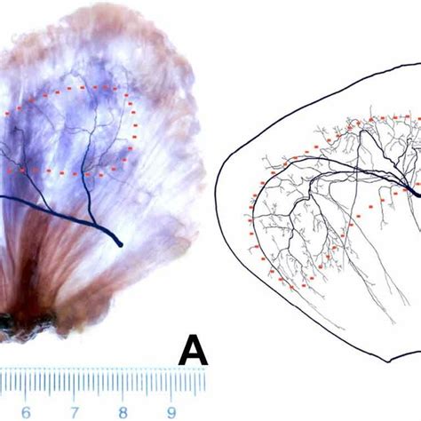 Extra And Intramuscular Nerve Distribution Pattern Of The Right Gluteus