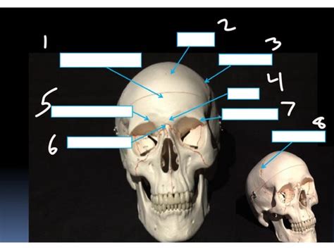 Frontal Bone Of The Skull Flashcards Quizlet