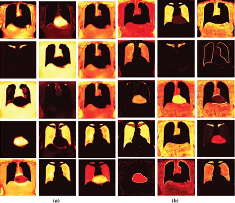 Activation Maps Obtained From The Third To Last Layer Of The Unet
