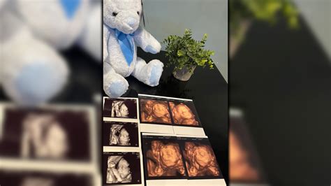 Mujer Busca A Jovencito Que Conoci En Vacaciones Para Decirle Que Ser Pap