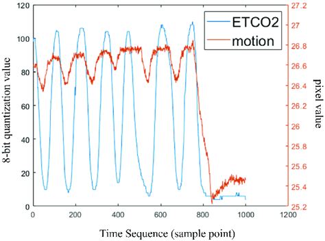 The Waveform Of Etco2 Ground Truth And Motion Signal Extracted From