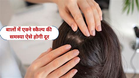 Hair Care Tips City Tehelka