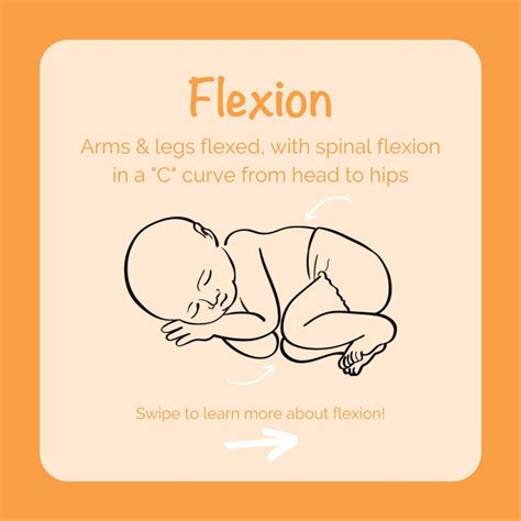 5 Key Tenets Of Neurodevelopmentally Supportive Positioning™ Deep Dive Dandle•lion Medical