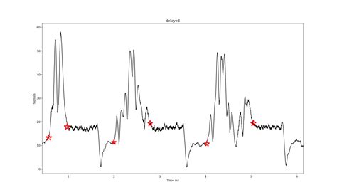 Filters Signal Analysis Selection Of Oscillatory Parts Signal